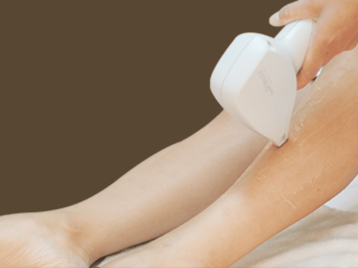 Comment se préparer à une séance d'épilation laser ? - Beauté Ultime